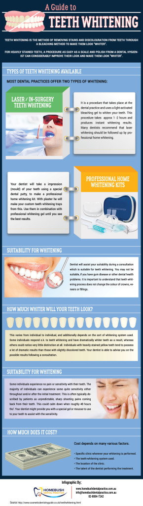 A Guide To Teeth Whitening - Infographic